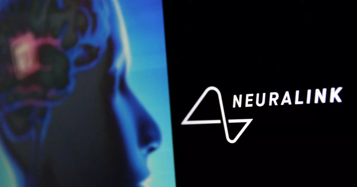 Человек с имплантом Neuralink смог управлять компьютерной мышью — Delo.ua